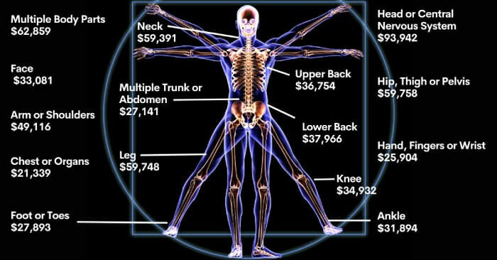California Workers’ Comp Settlement Chart by Injury Type & Cause 2025